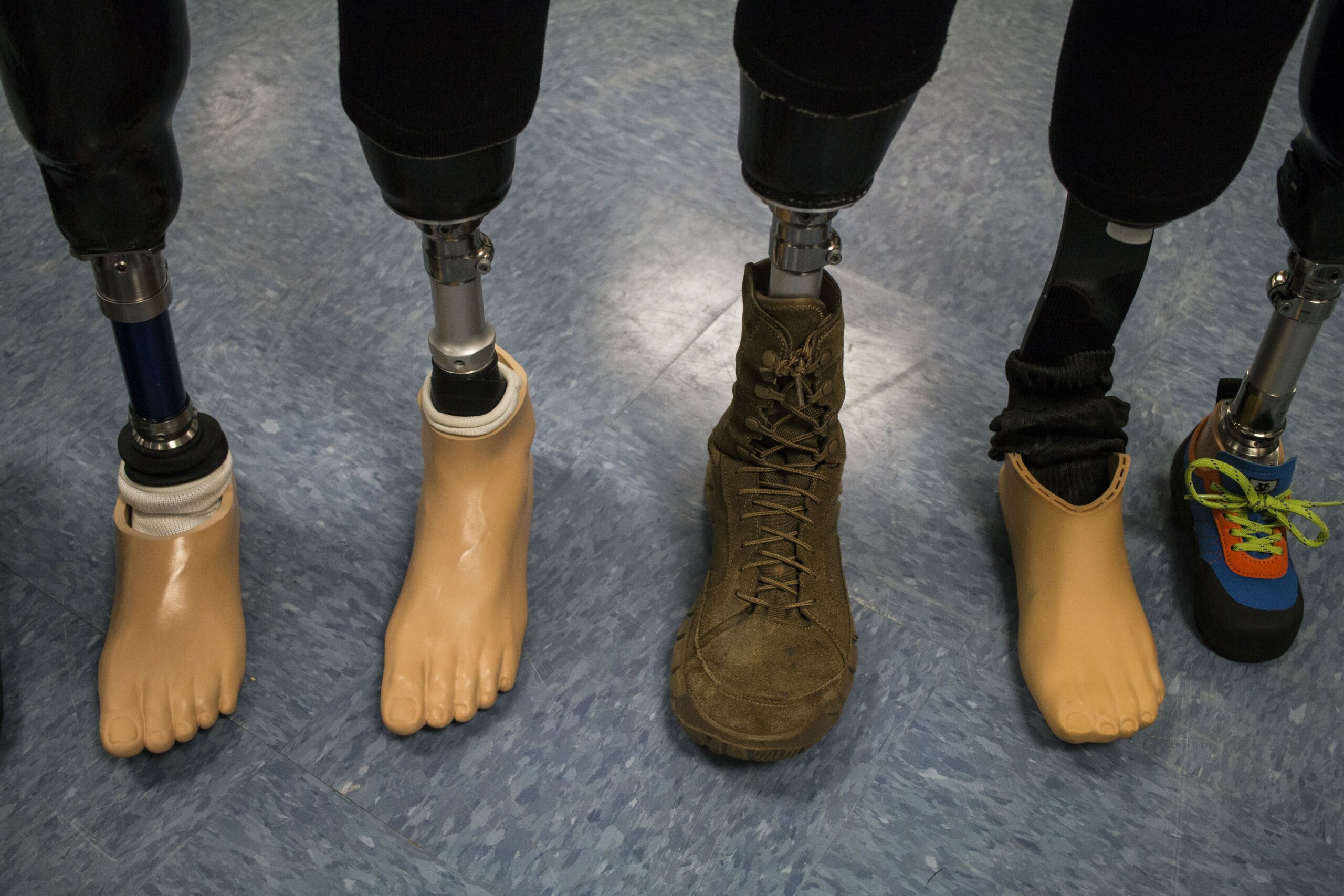 Innovative Attachment Systems for Improved Performance of Prosthetics ...
