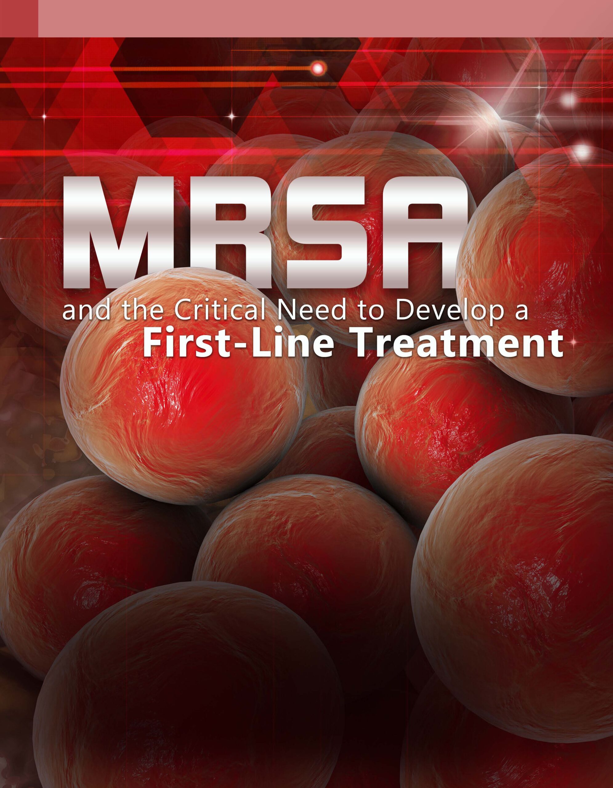 MRSA and the Critical Need to Develop a First-Line Treatment - HDIAC