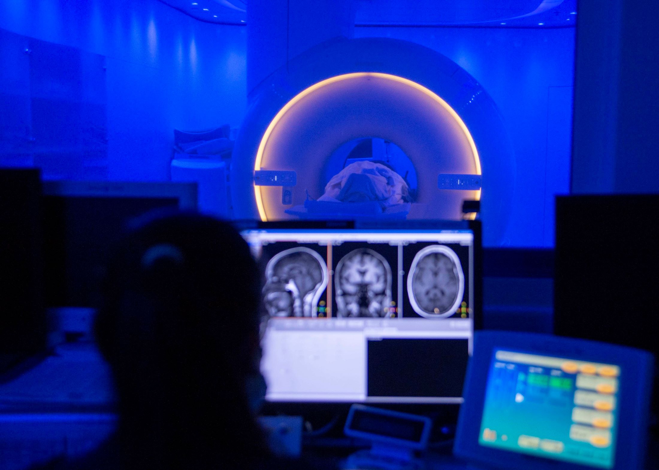 Using Dynamic MRI to Advance Traumatic Brain Injury Research - HDIAC